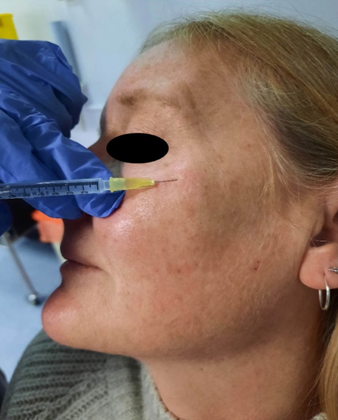 Journal of Oral & Facial Pain and Headache (OFPH)