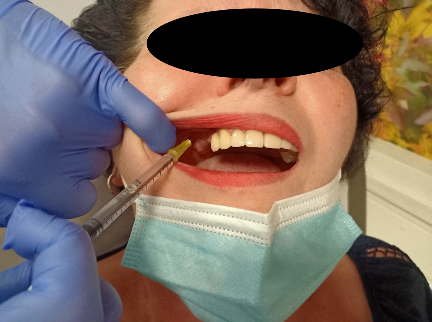 Journal of Oral & Facial Pain and Headache (OFPH)