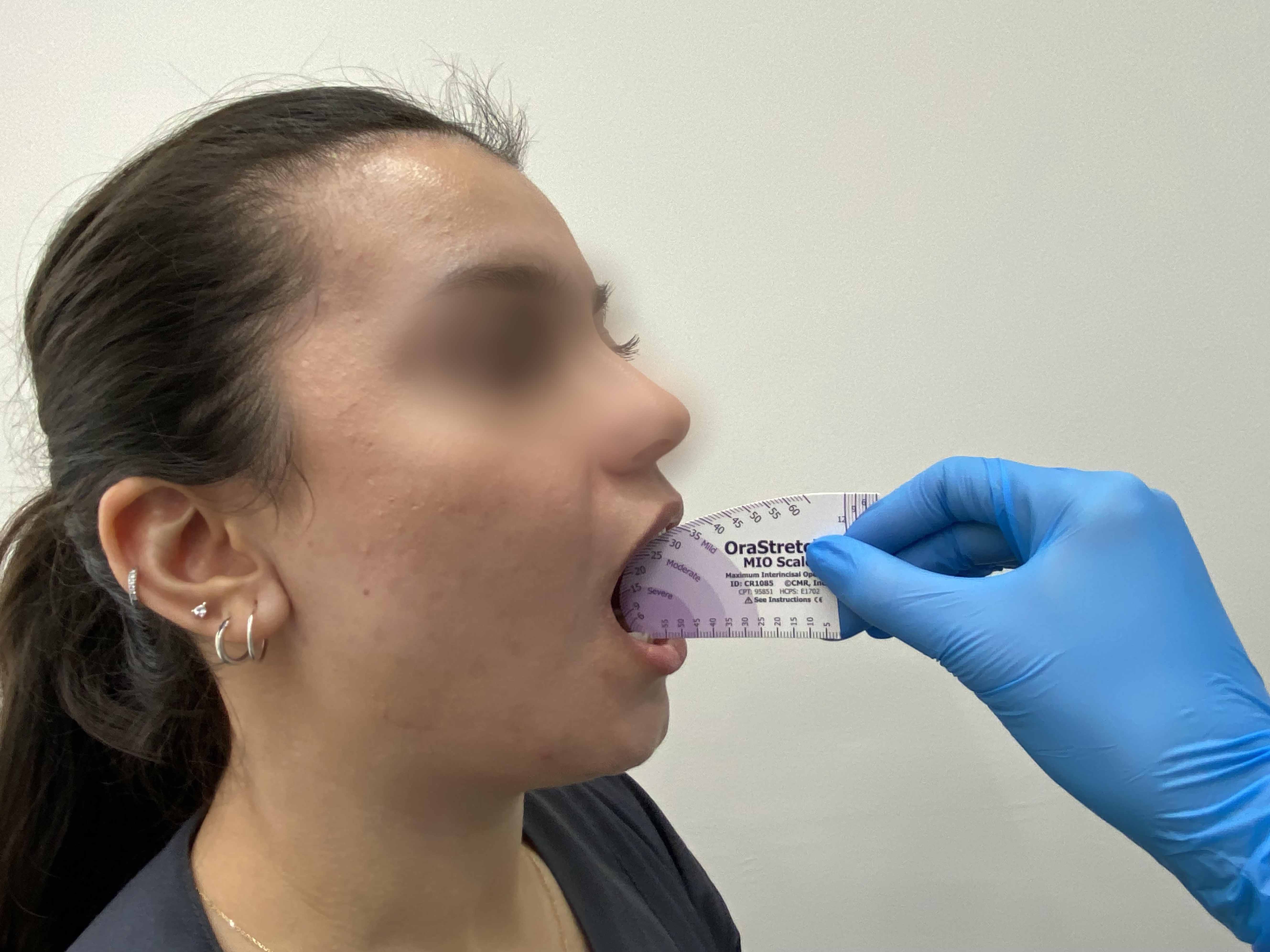 Journal of Oral & Facial Pain and Headache (OFPH)