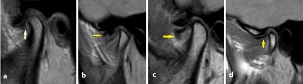Journal of Oral & Facial Pain and Headache (OFPH)